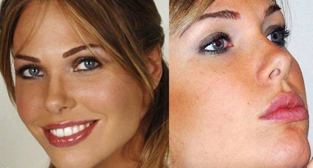 Vip fatti e rifatti: ecco le foto di 20 star prima e dopo gli interventi