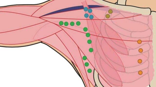 linfonodi ascellari riconoscerli e curarli tutti i consigli